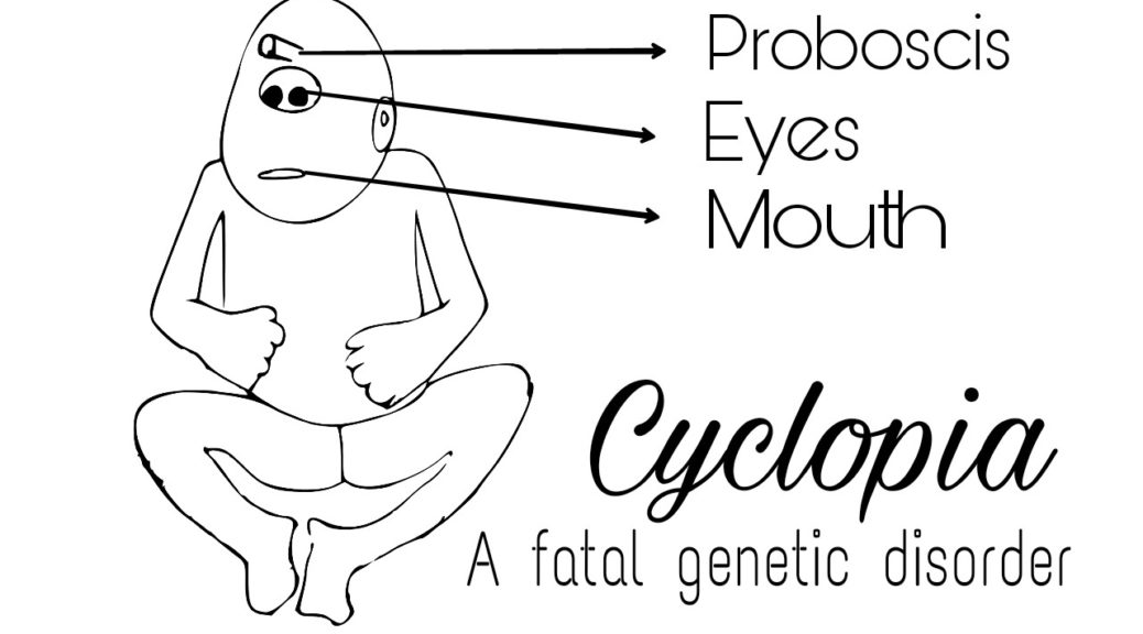 (Video) Bayi Cyclopia, Derita Dilahirkan Bermata Satu, Tapi Sedihnya ...