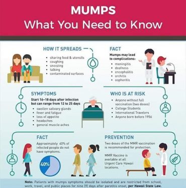 Beguk Boleh Berjangkit, Ini Apa Yang Anda Perlu Tahu Mengenai Penyakit Ini