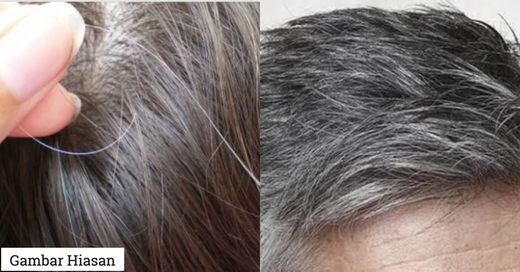 Uban Tumbuh Di Usia Muda, Ini Penjelasan Yang Anda Perlu Tahu