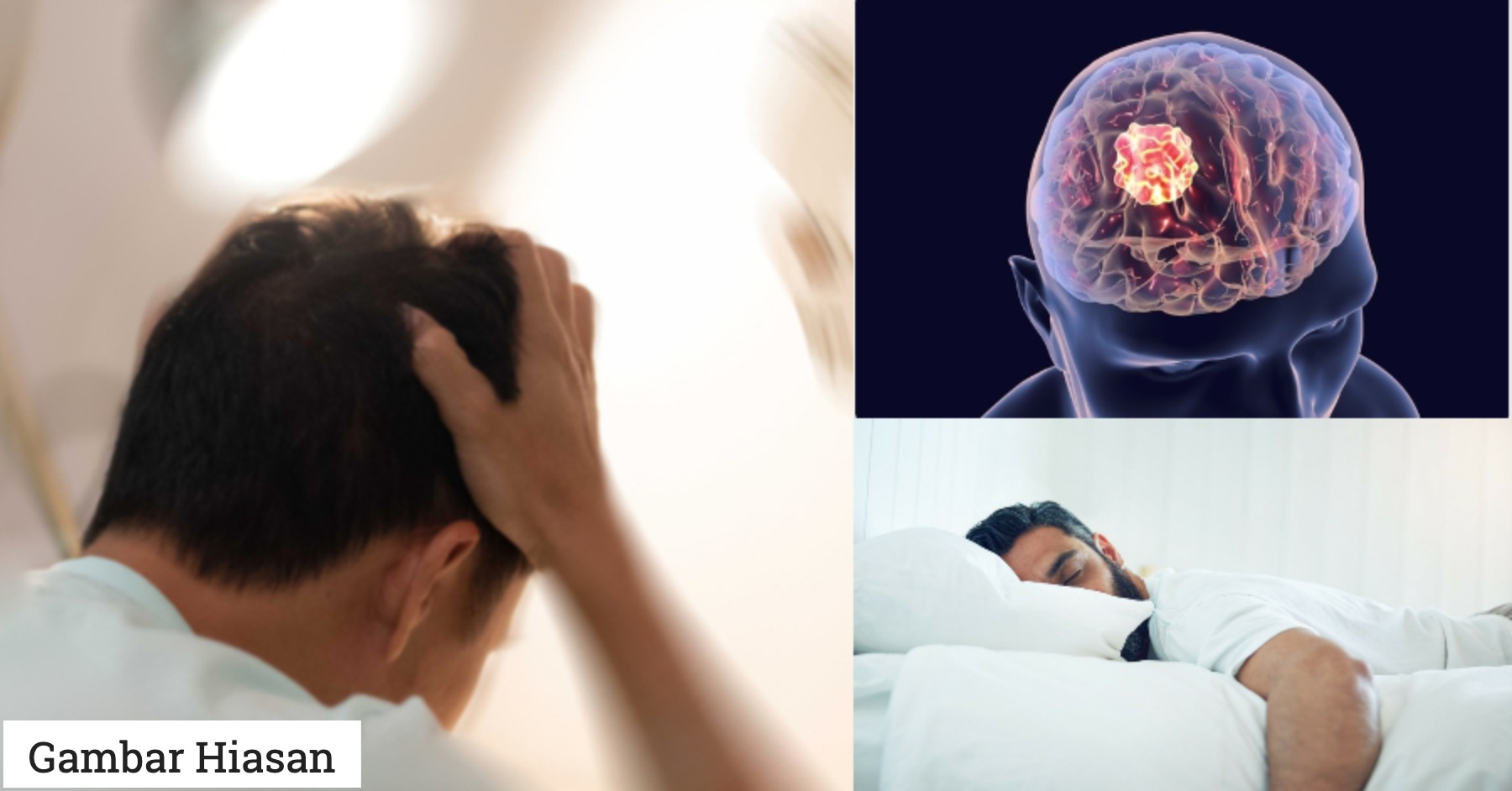 Ketahui 10 Gejala Hidap Penyakit Tumor Otak, Salah Satunya Ialah Kerap Mengantuk