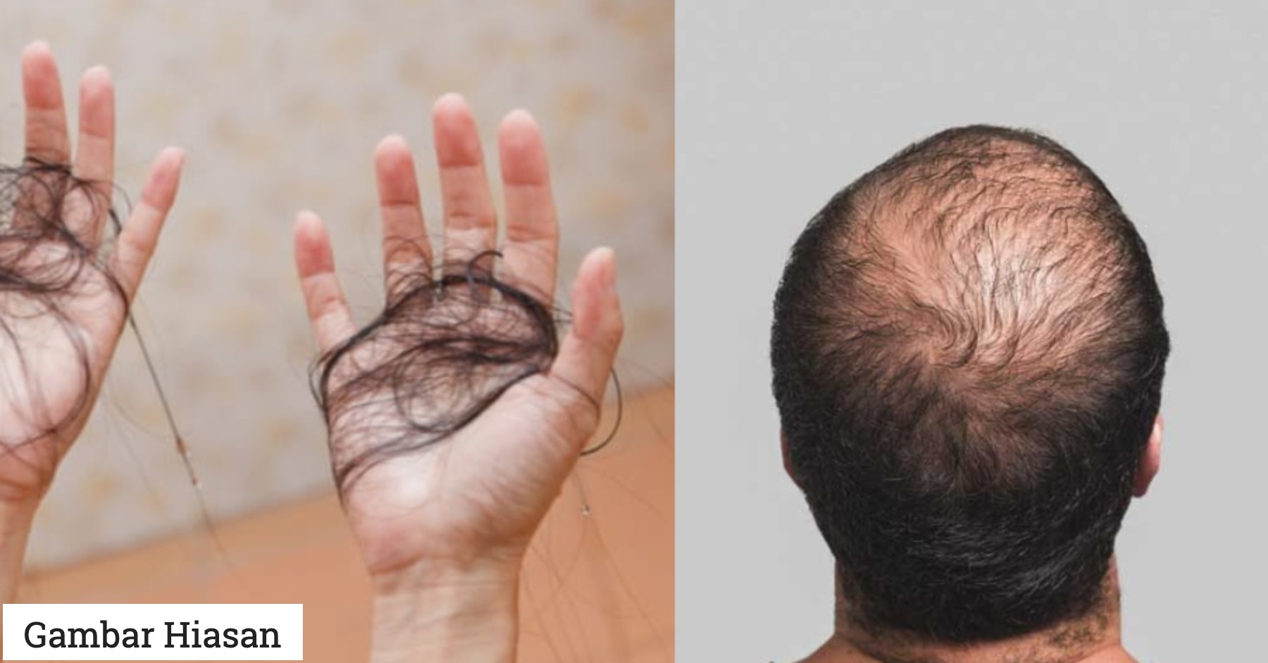 Tips Lebatkan Rambut Secara Semula Jadi Dan 12 Makanan Atasi Masalah ...