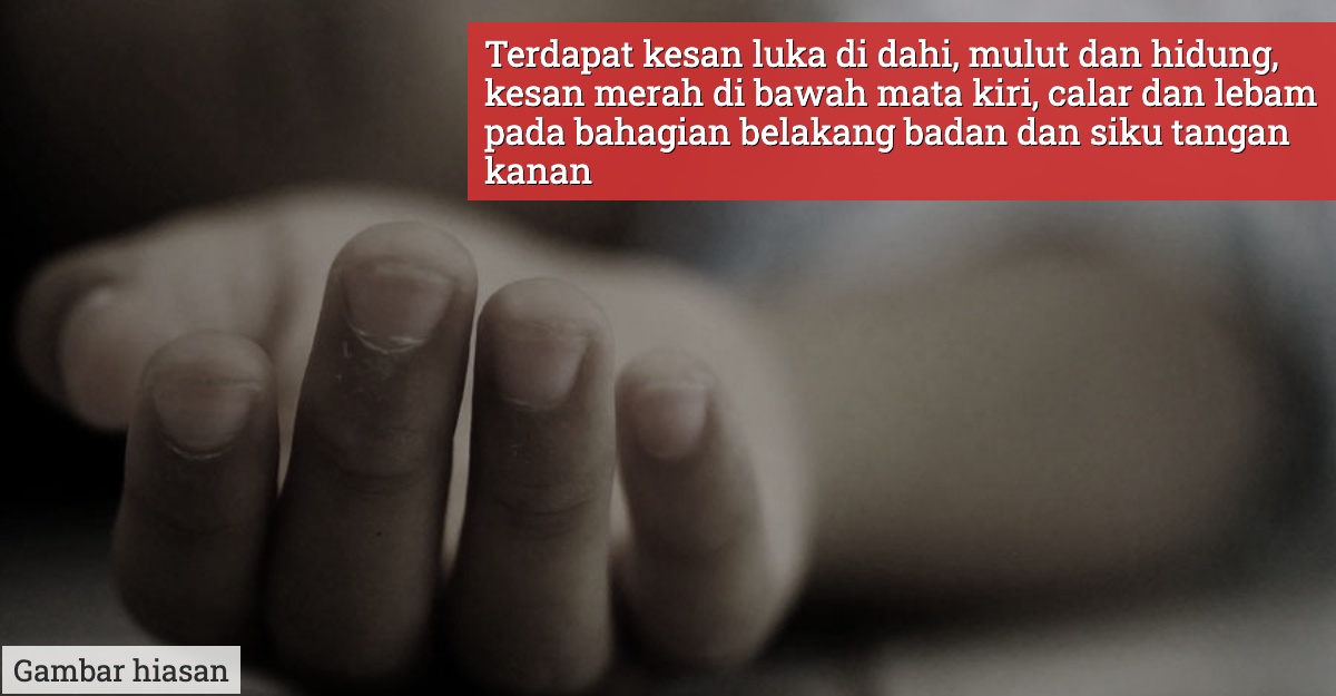 Kanak-Kanak Lelaki Tiga Tahun Ditemui Mati, Dipercayai Didera Pengasuh