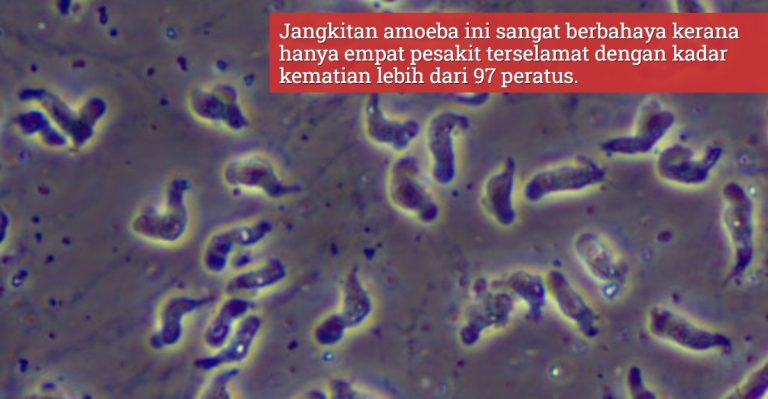 Lelaki Warga Emas Dilapor Maut, Korea Selatan Catat Kes Pertama Jangkitan Amoeba Pemakan Otak