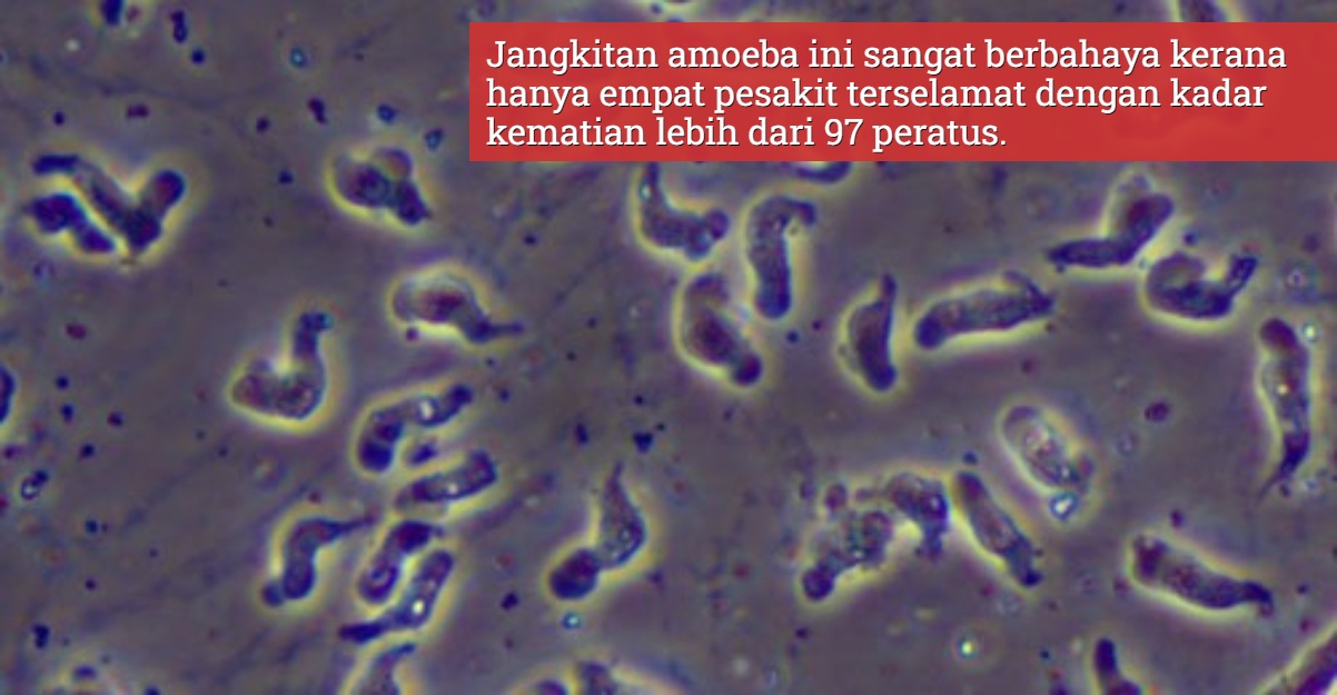 Lelaki Warga Emas Dilapor Maut, Korea Selatan Catat Kes Pertama Jangkitan Amoeba Pemakan Otak
