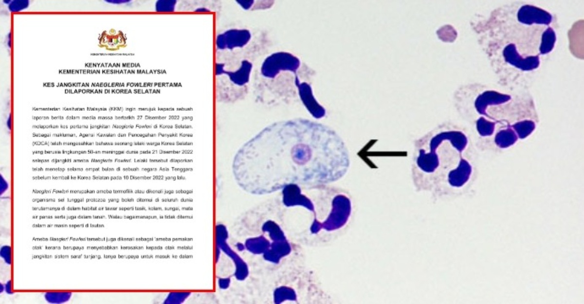 Kes Ameba Pemakan Otak Di Korea Selatan, KKM Minta Orang Ramai Hati-hati Ketika Buat Aktiviti ...