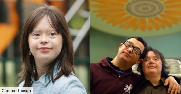 Iceland & Beberapa Negara Maju Lain Dijangka Bebas Sindrom Down Dalam Tempoh Kurang 20 Tahun ...