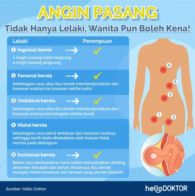 Awas, Bukan Lelaki Sahaja, Perempuan Pun Ada Potensi Kena Angin Pasang
